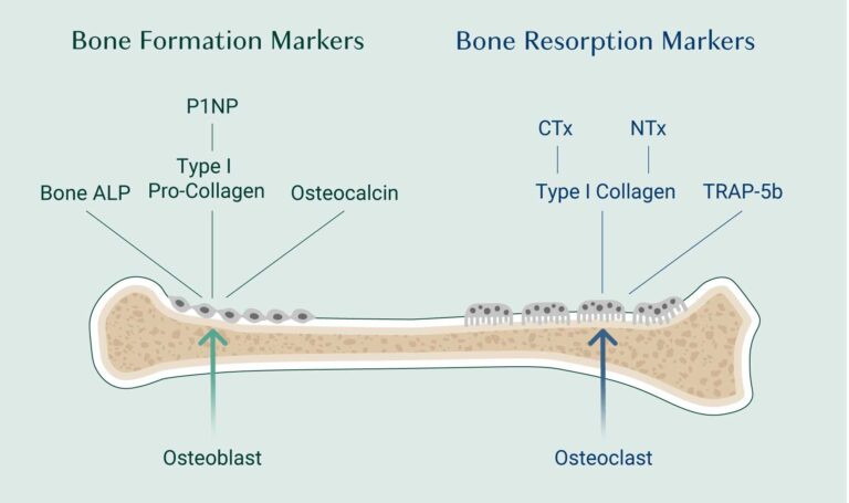 Discover Your Bone Health: Check Your Bone Turnover Markers