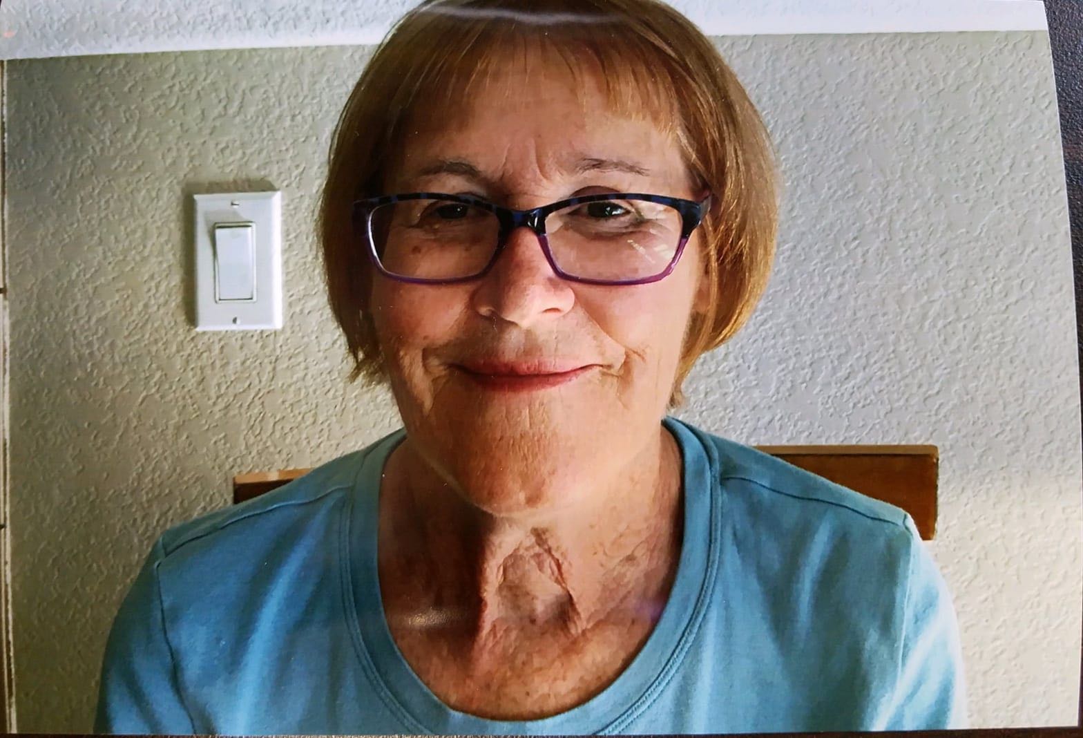 For the First Time in 13 Years, Eve’s DEXA Results Changed for the ...