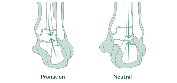 8 Plantar Fasciitis Exercises for Pain Relief, Strength, and Flexibility